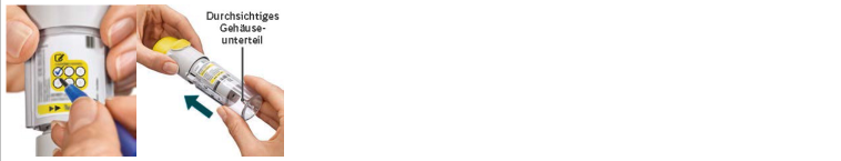 Striverdi® Respimat® 2,5 Mikrogramm - Lösung zur Inhalation