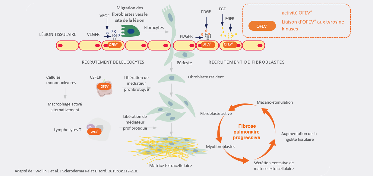 Traitement avec OFEV | Boehringer Ingelheim Pro
