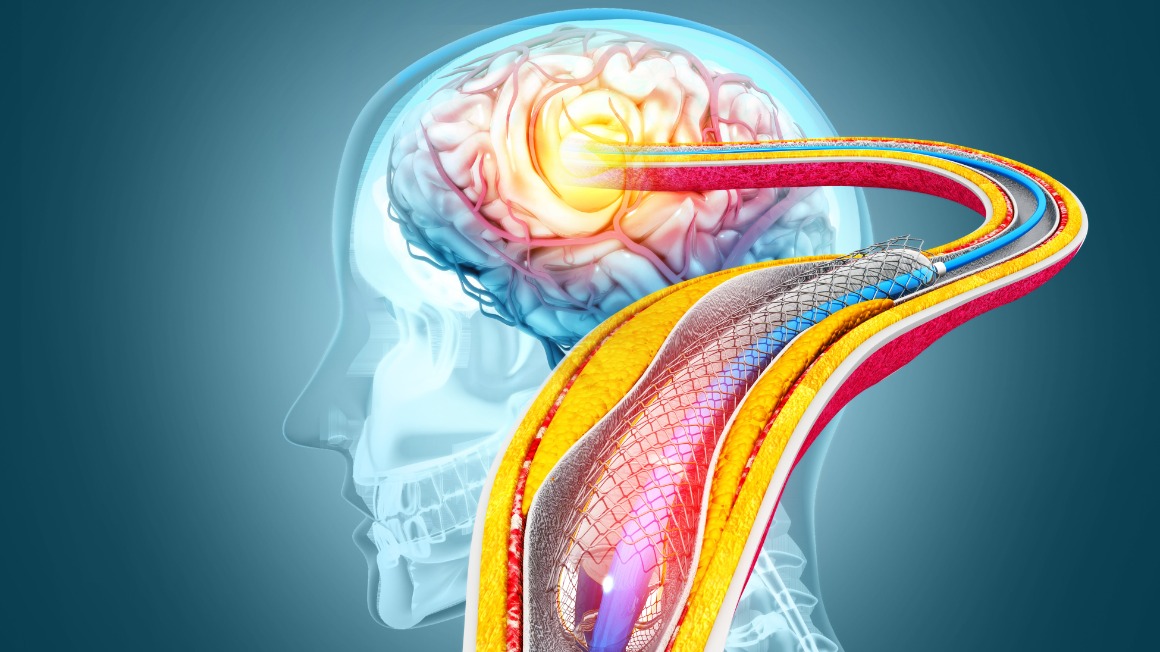 Highlights ESOC 2025 | Boehringer Ingelheim