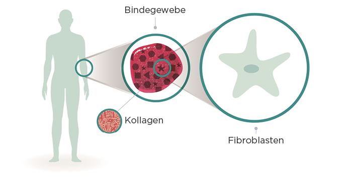 SSc-ILD | Boehringer Ingelheim