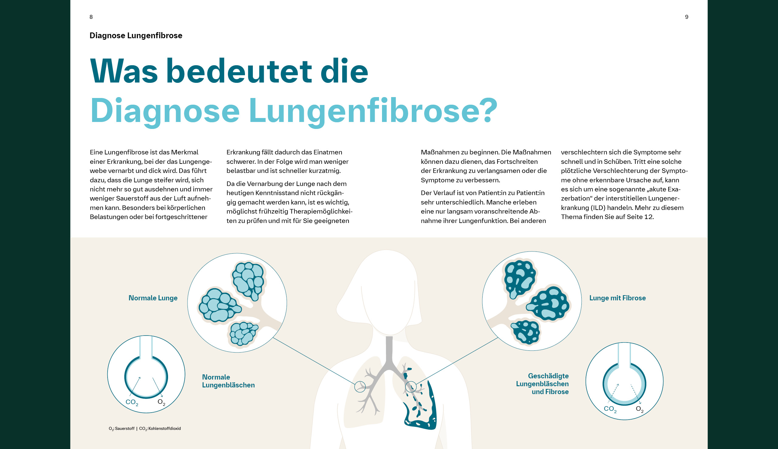 Lungenfibrose verstehen: Broschüre für Betroffene | Boehringer Ingelheim