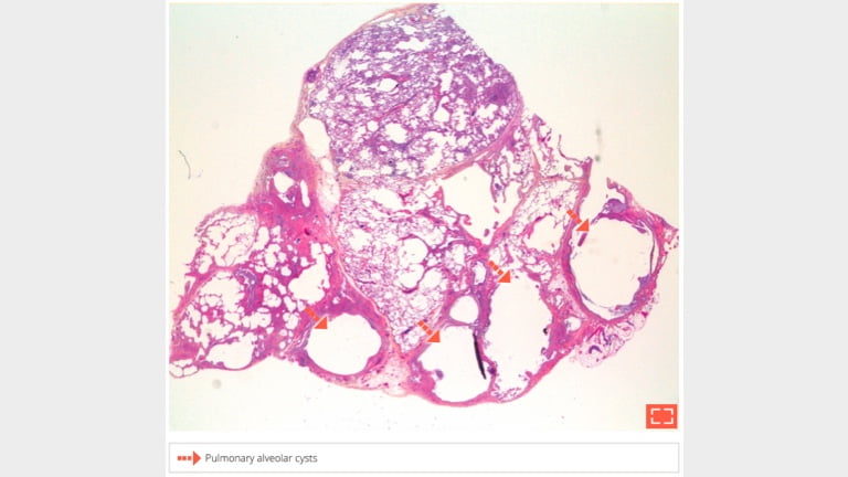 Honeycomb change | Boehringer Ingelheim | Imaging Atlas