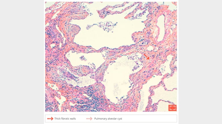 Honeycomb change | Boehringer Ingelheim | Imaging Atlas
