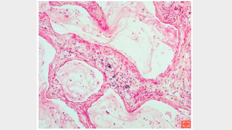 Honeycomb change | Boehringer Ingelheim | Imaging Atlas