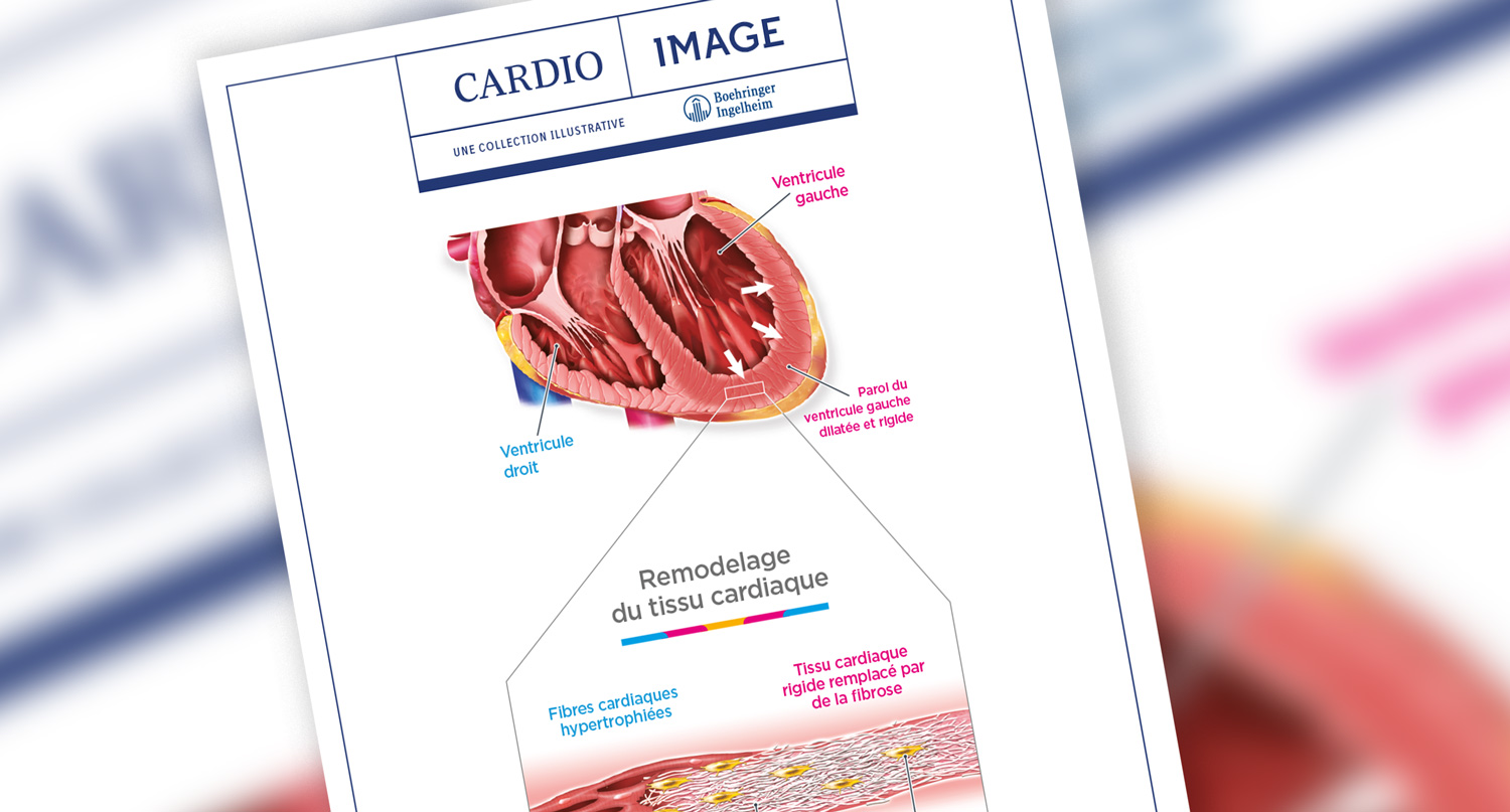 Planche n°1 : Anatomie du cœur - coupe transversale