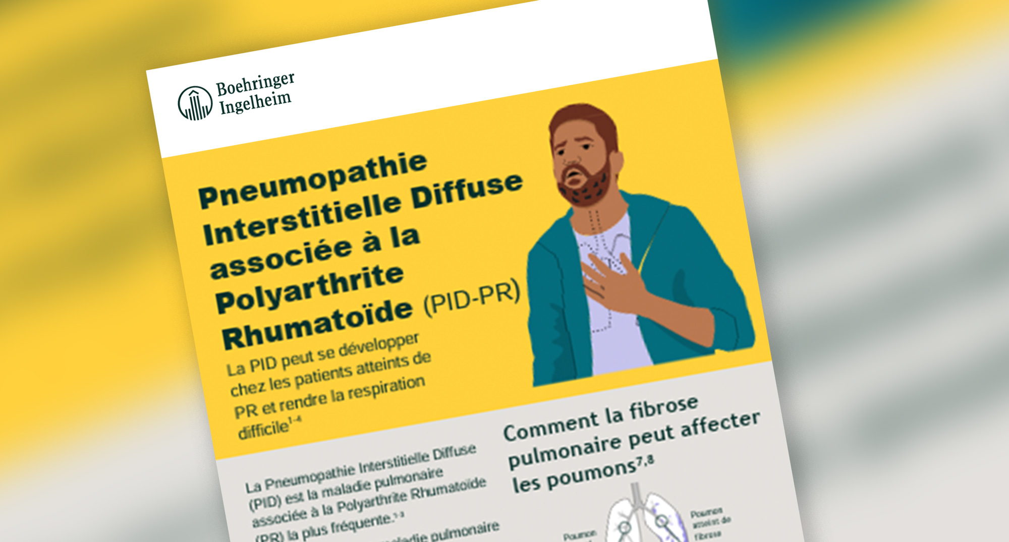 Prise en charge de la FPI : Regards croisés patients & soignants