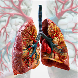 Fisiopatologia della malattia bronchiectasica | Medaffairs