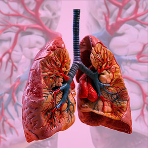 Che cosa sono le bronchiectasie? | Medaffairs