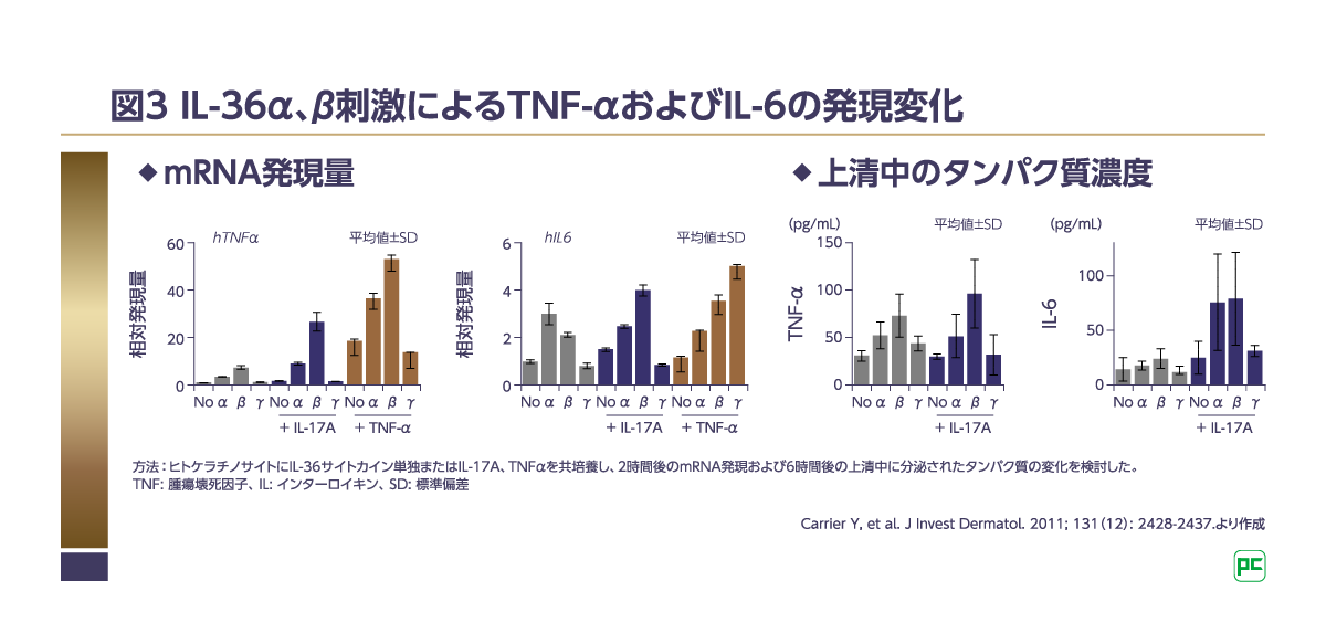 GPPの病態形成におけるIL-36による炎症誘導とは | べーリンガープラス