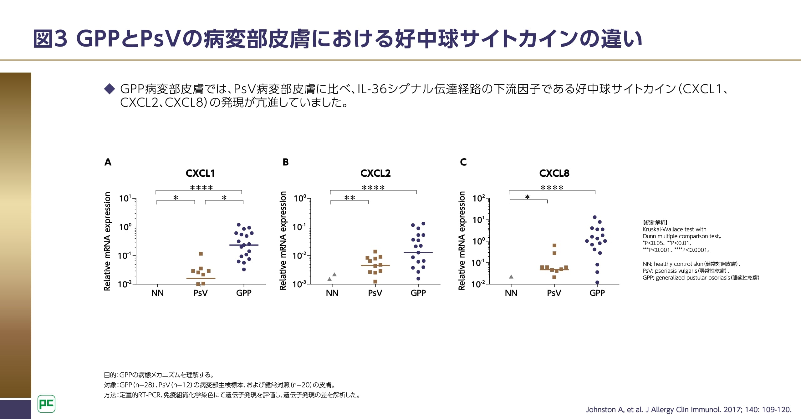 GPPの病変部皮膚におけるIL-36シグナル伝達経路の重要性 | べーリンガープラス