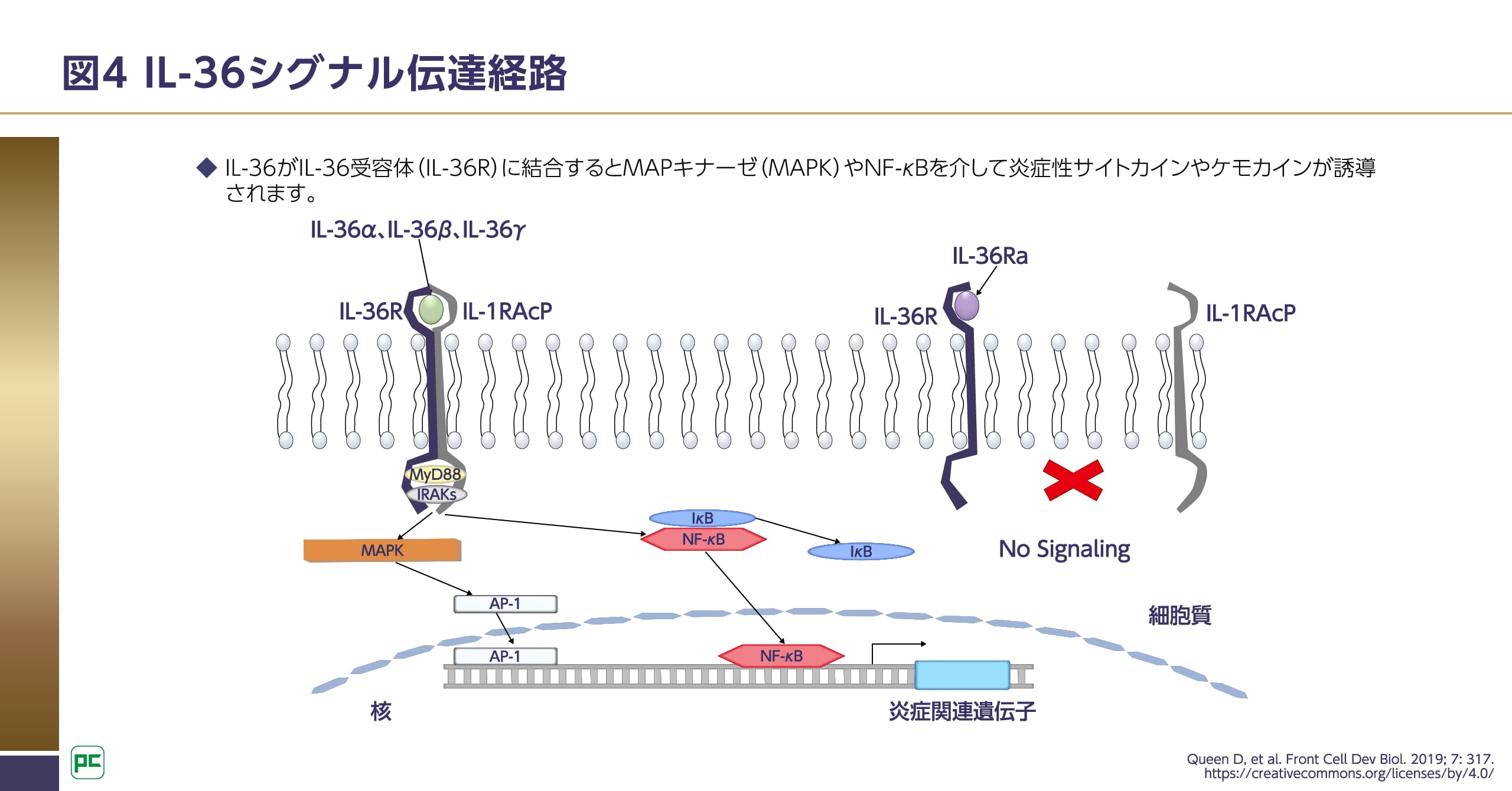 GPPの病変部皮膚におけるIL-36シグナル伝達経路の重要性 | べーリンガープラス