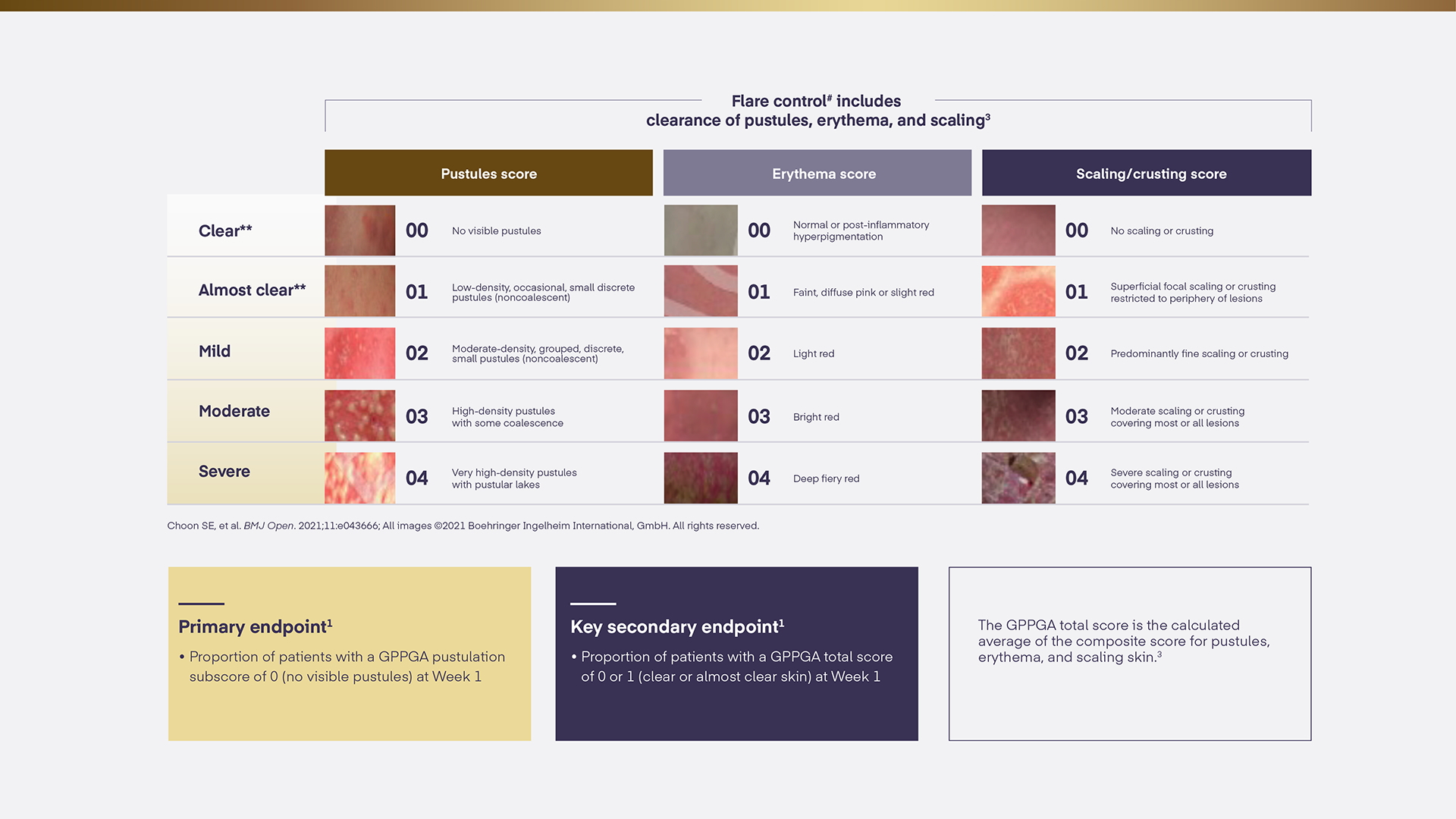 Generalized Pustular Psoriasis Clinical Study