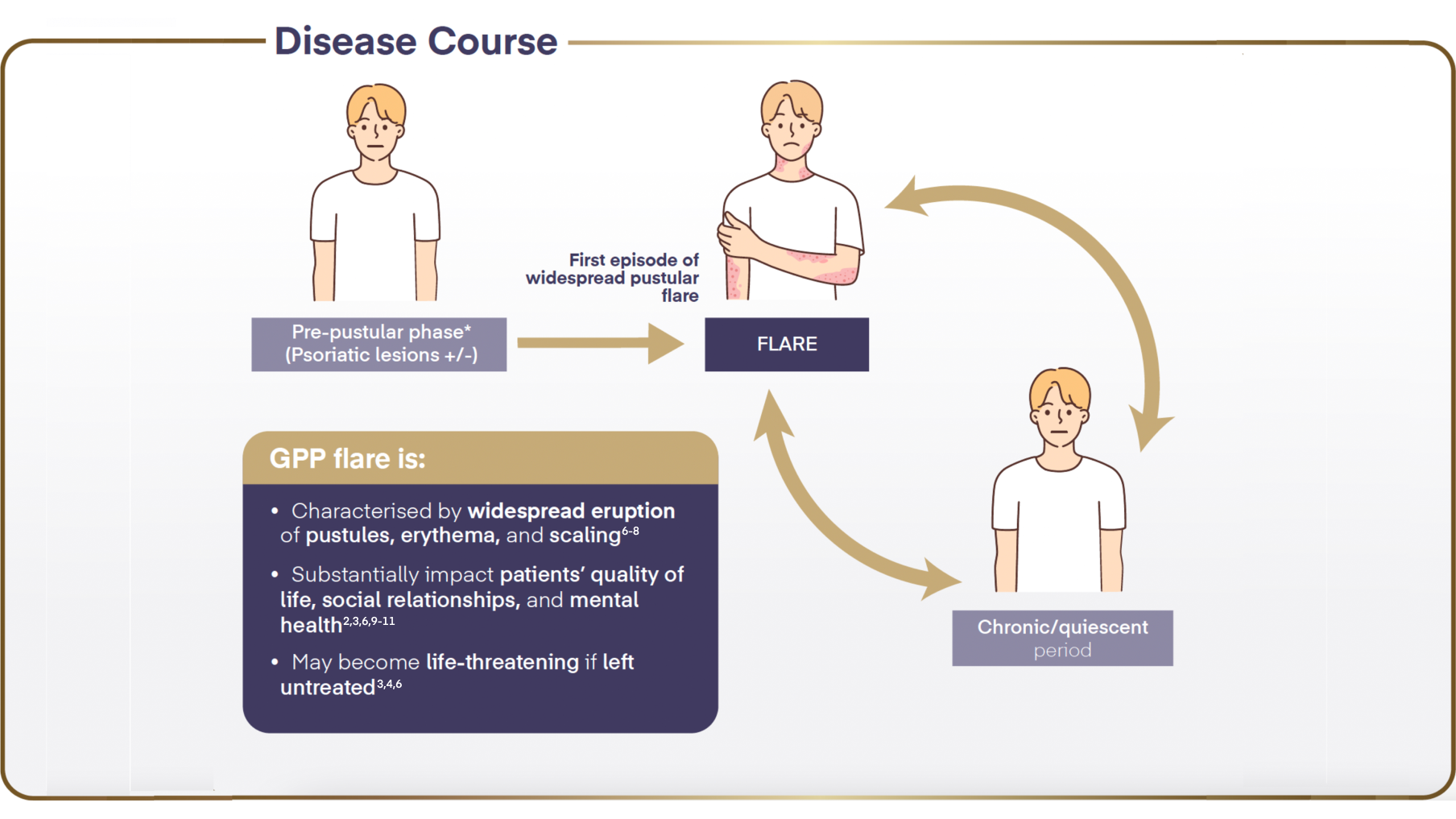 About GPP | GPP flares | GPP Images