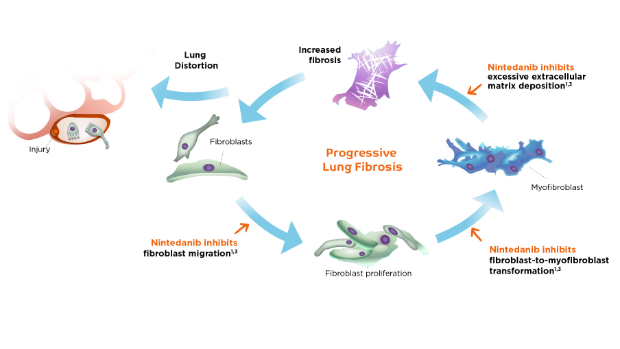 Understanding OFEV's Mechanism of Action