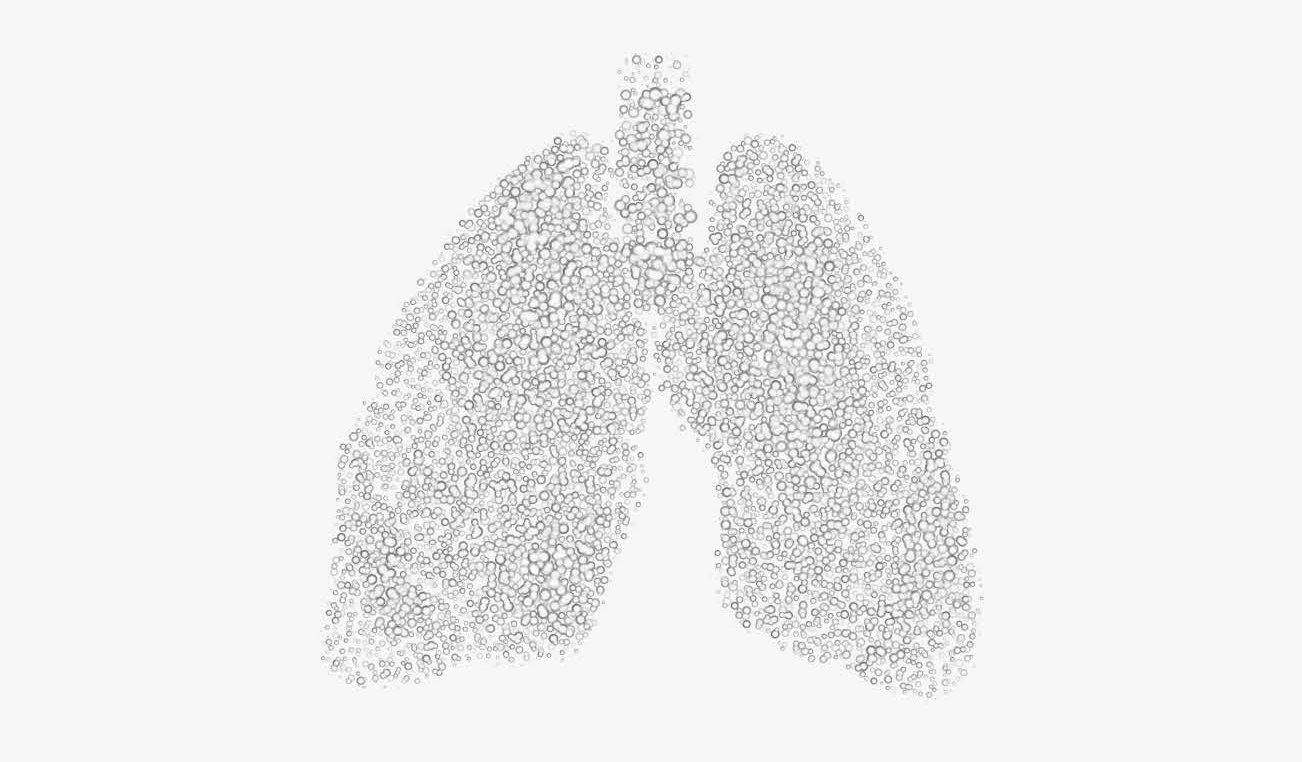 Pulmonary Fibrosis – recognise signs early I Boehringer Ingelheim NO