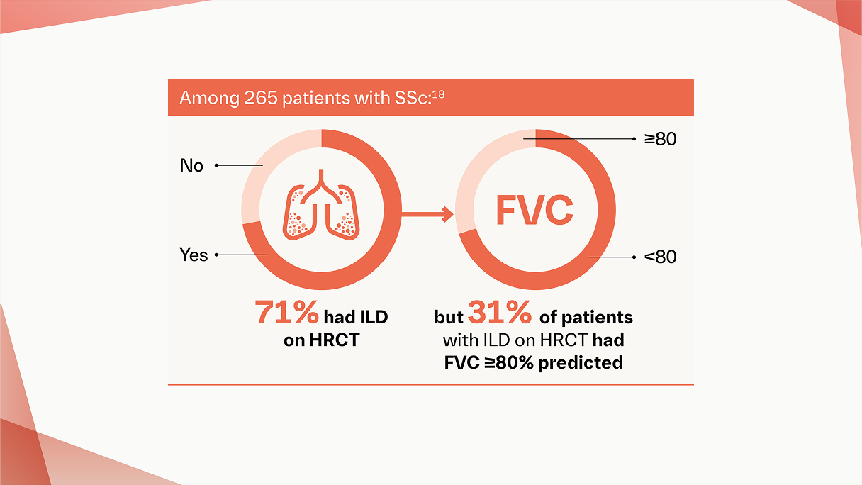 Systemic Sclerosis-Associated ILD | Rheumatologists | PF360