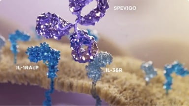 Generalized Pustular Psoriasis | SPEVIGO® (Spesolimab)