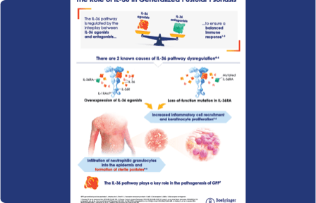 The Pathology of Generalized Pustular Psoriasis | GPP Walks In