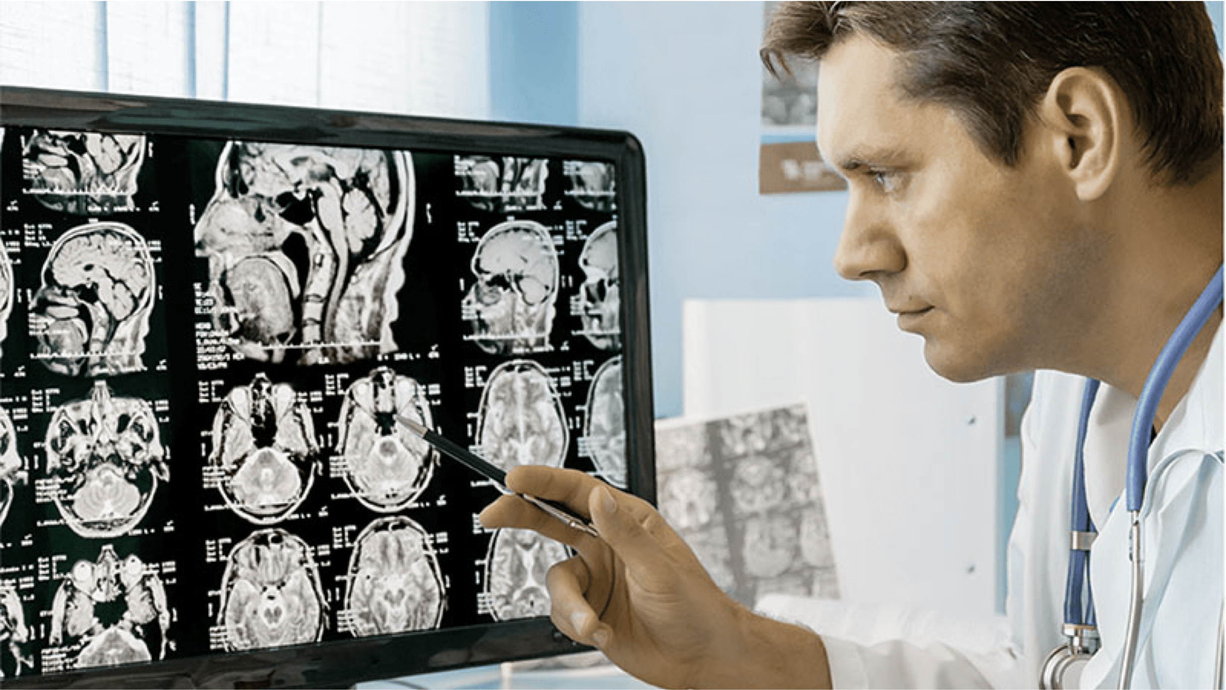 Telemedicine in Stroke | Strokeforum