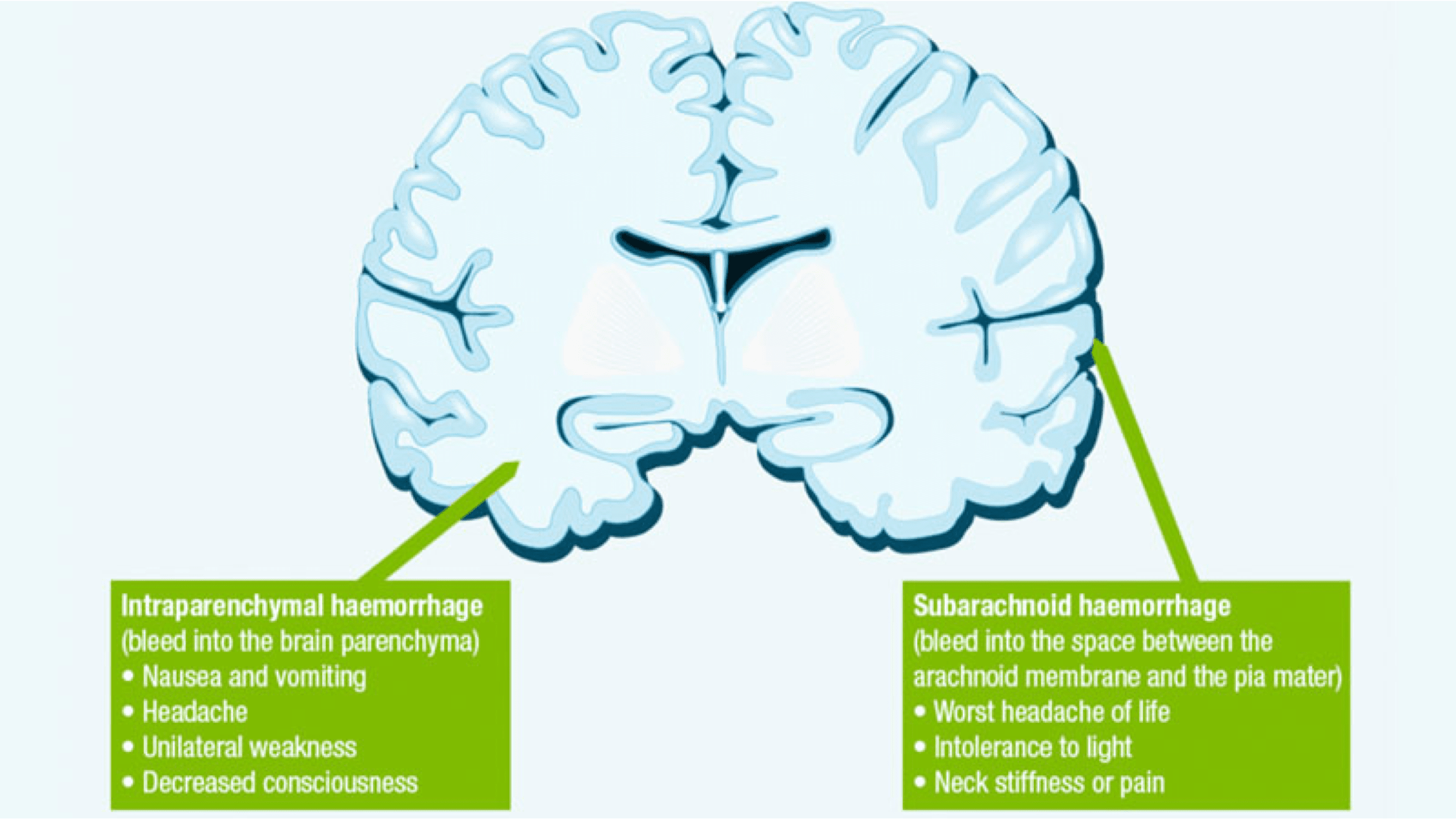 Symptoms and Mimics | Strokeforum