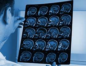 Excellence in stroke | Strokeforum