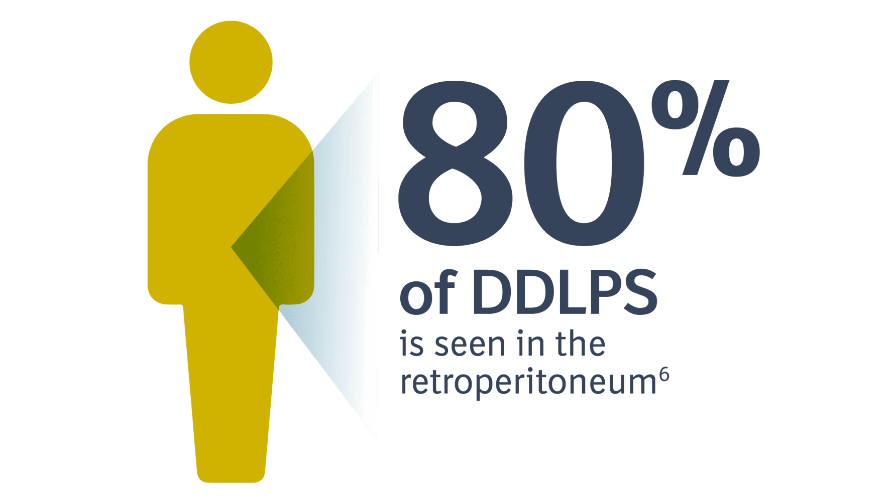 Understanding Dedifferentiated Liposarcoma (DDLPS cancer)