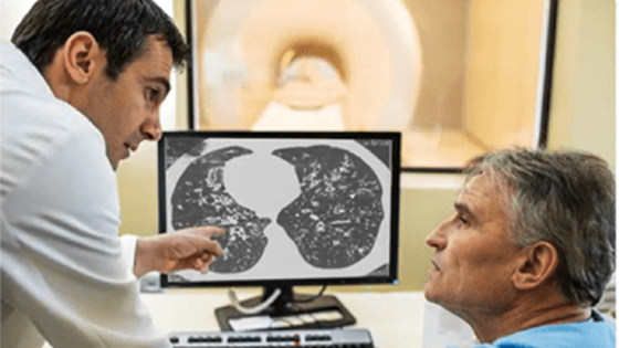 Fibrotic HP Case Study | ILD Radiology Rounds