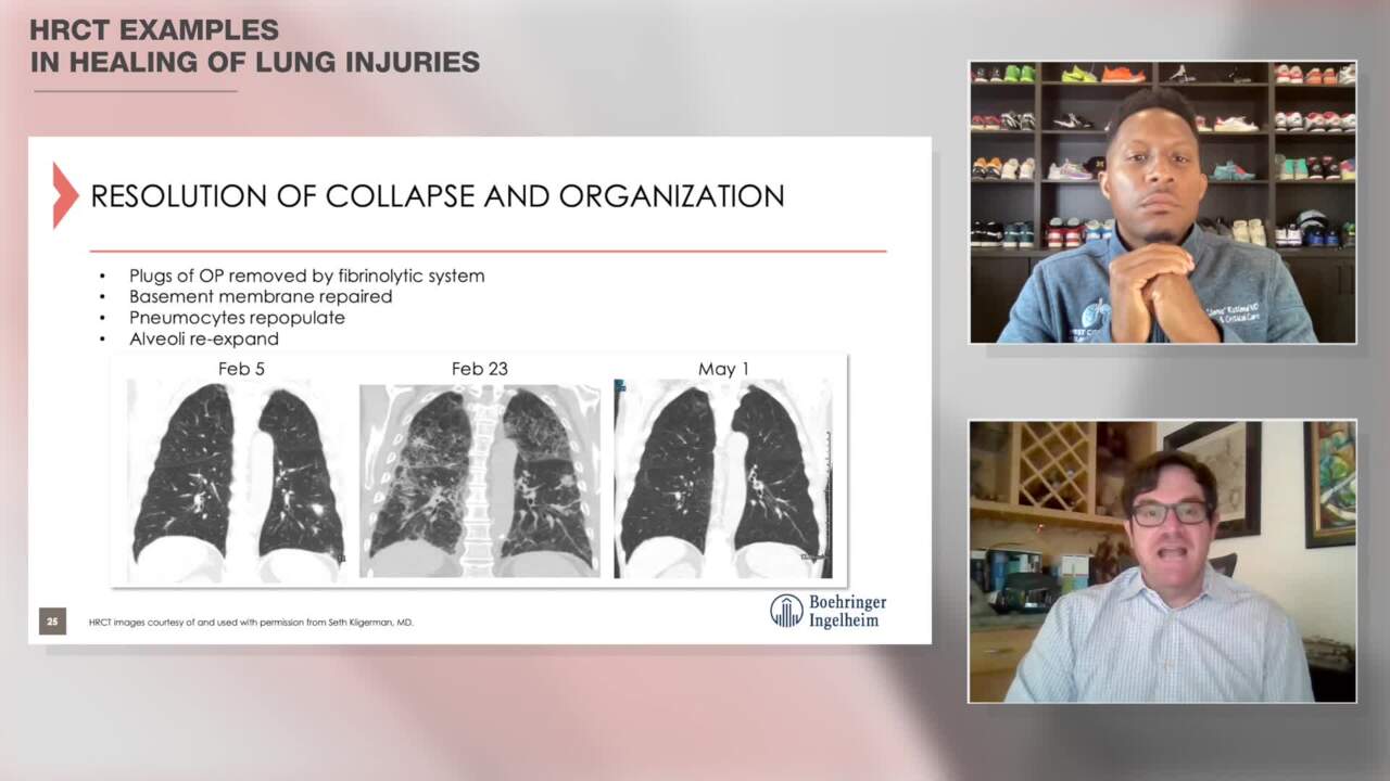 Interstitial Lung Disease Media Library | Insights in ILD