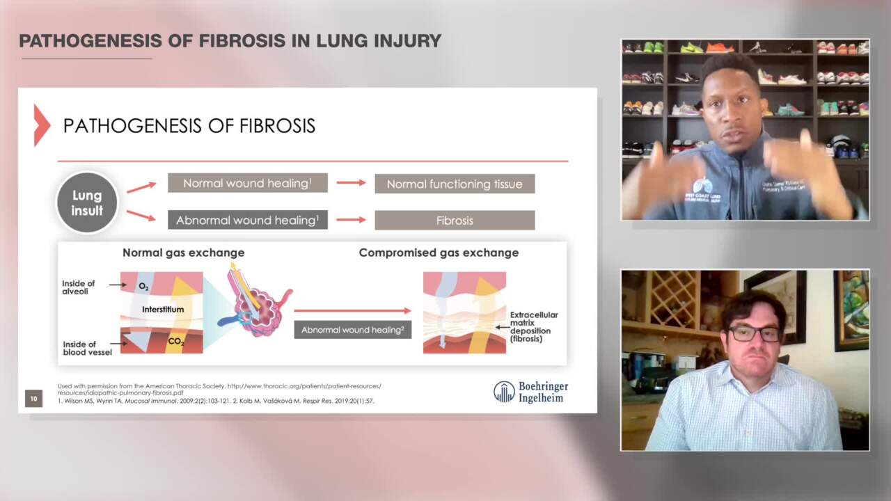 Interstitial Lung Disease Media Library | Insights in ILD