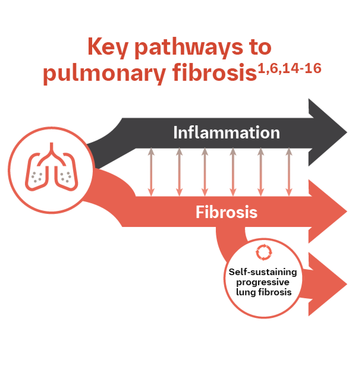 Complexities of Interstitial Lung Disease | Insights in ILD