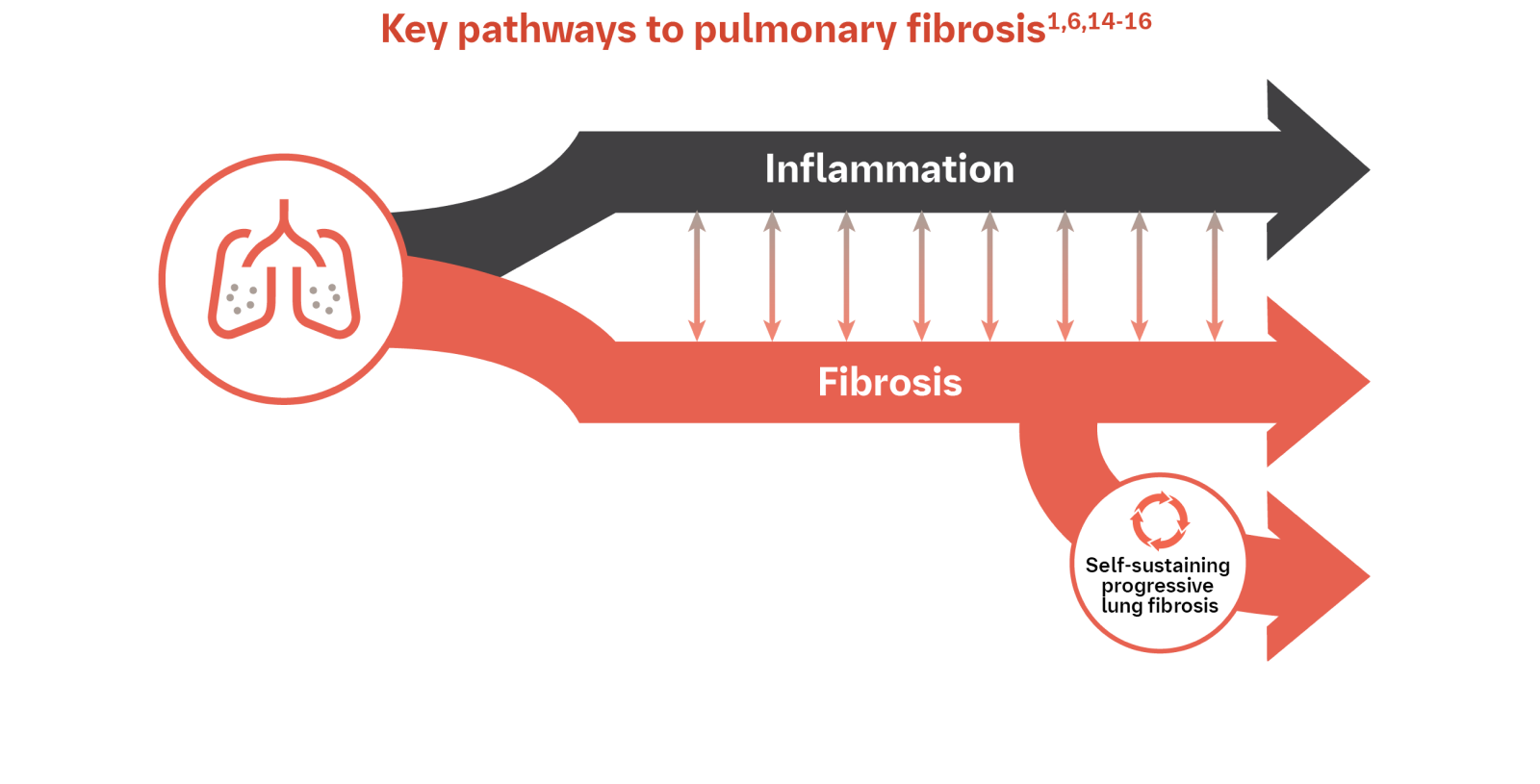 Complexities of Interstitial Lung Disease | Insights in ILD