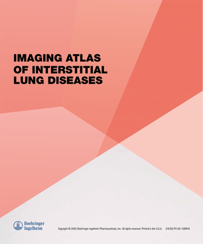 Imaging Atlas of Interstitial Lung Diseases | Insights in ILD