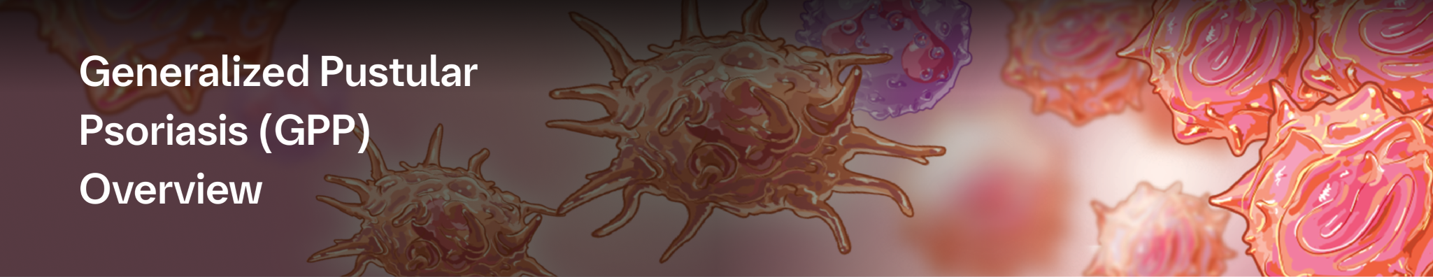 Generalized Pustular Psoriasis | BI Immunology Resources