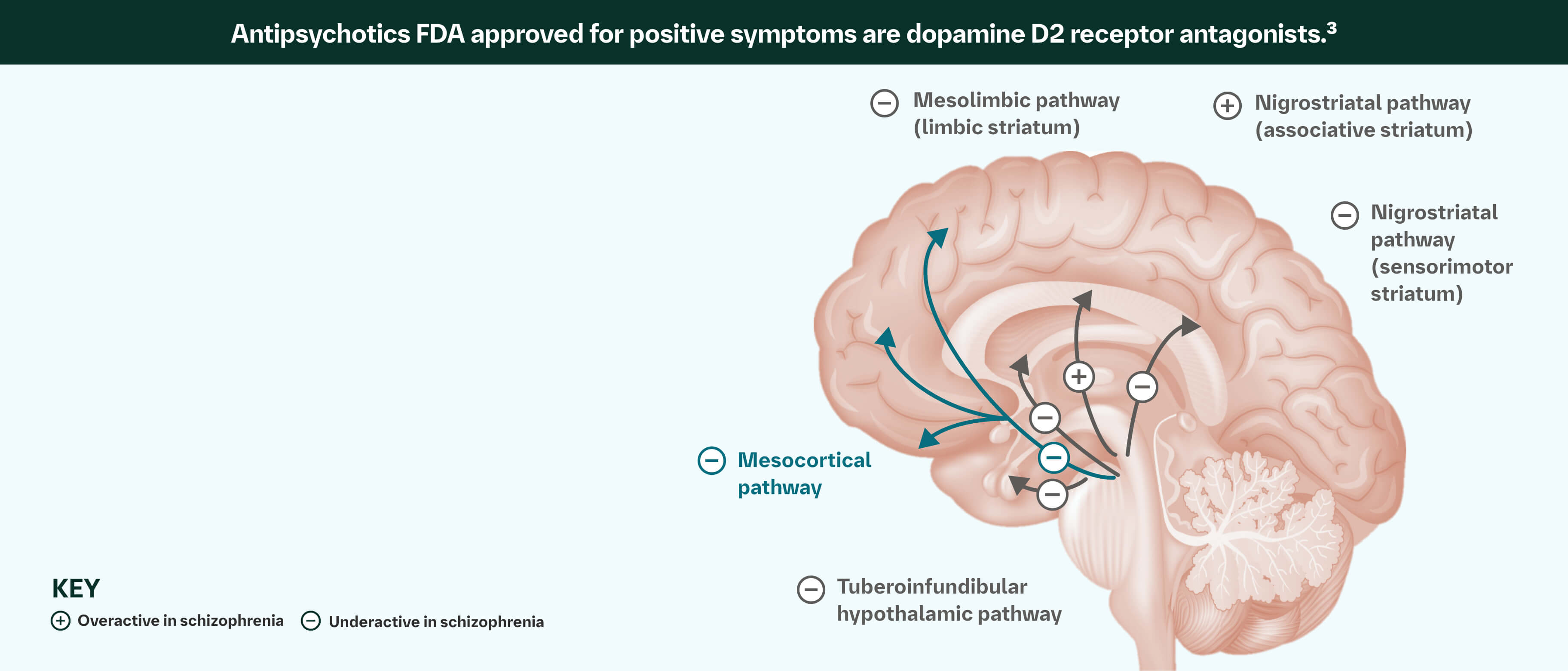 Mechanism of Disease of Schizophrenia | Vital Perspectives