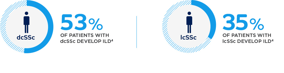 SSc-ILD (ILD related to Scleroderma) | OFEV® (nintedanib)